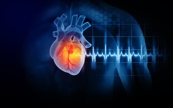 Psych News Alert: Heart Attack Linked to Faster Cognitive Decline Over ...